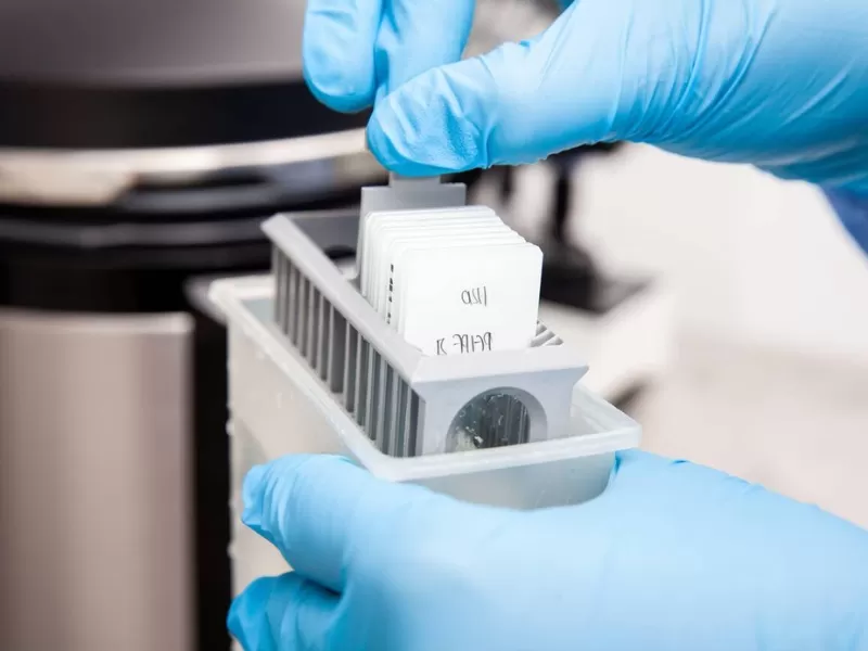 Immune tissue chemical: Testing of spearhead in diagnosis, treatment ...